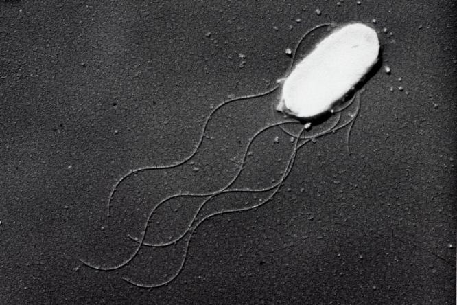 修学旅行でレストランを利用した『170人発症・30人入院』 「O157」集団食中毒 店を【営業禁止】処分に… - デイリーニュースオンライン