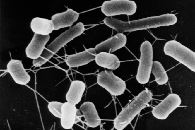 修学旅行でレストランを利用した『170人発症・30人入院』 「O157」集団食中毒 店を【営業禁止】処分に… - デイリーニュースオンライン